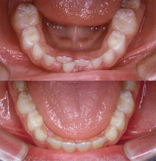 Best Pediatric Dentist in Stamford | Top Children's Dentistry CT