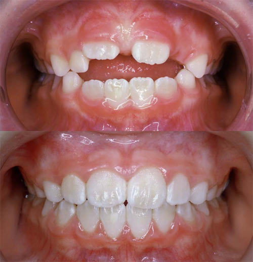 Best Pediatric Dentist in Stamford | Top Children's Dentistry CT