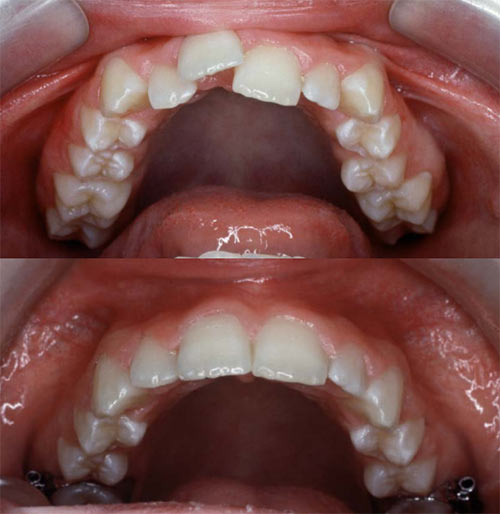 Best Pediatric Dentist in Stamford | Top Children's Dentistry CT