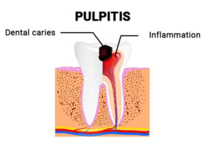 24 Hour Emergency Dentist in Stamford, CT | Urgent Dental Care in ...